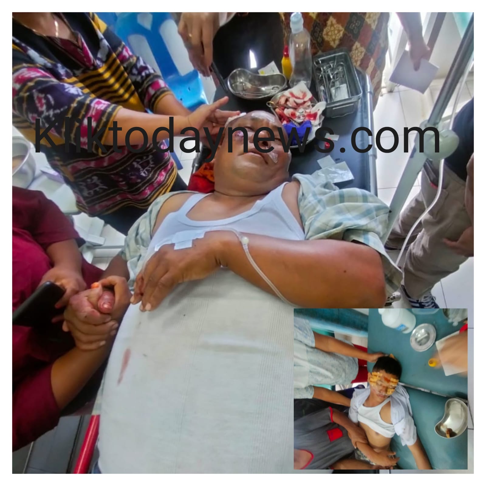 Dua Motor Tabrakan di Batu Bara, Kedua Pengendara Luka-luka - Berita ...